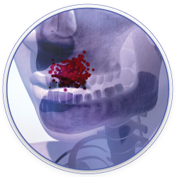 The Science | Sitavig (acyclovir), 50mg Muco-Adhesive Buccal Tablets